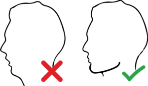 Proper Oral Rest Posture - Face Focused Orthodontics