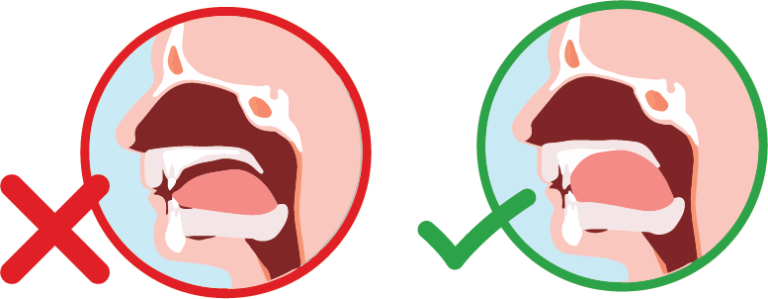 Proper Oral Rest Posture - Face Focused Orthodontics